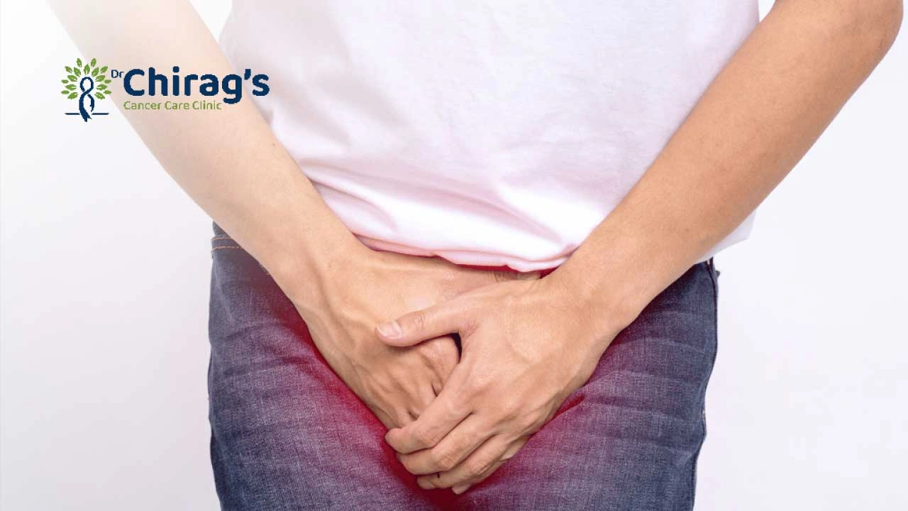 Is Bladder Cancer Curable? | Expert Oncology Guide